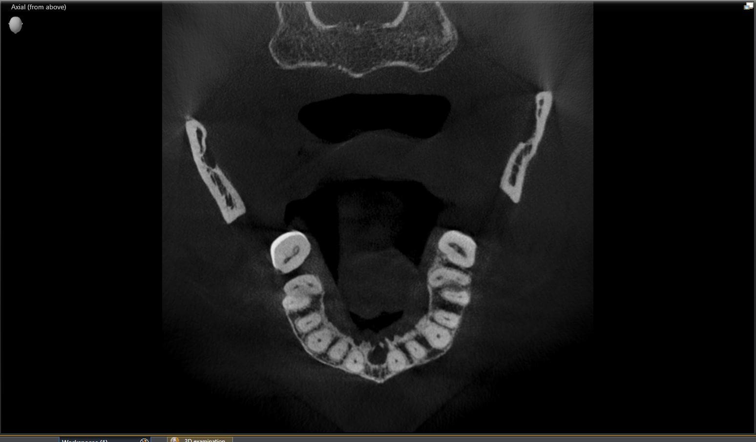 Benefits of the Cone Beam CT Scan at Origin Dental Wellness